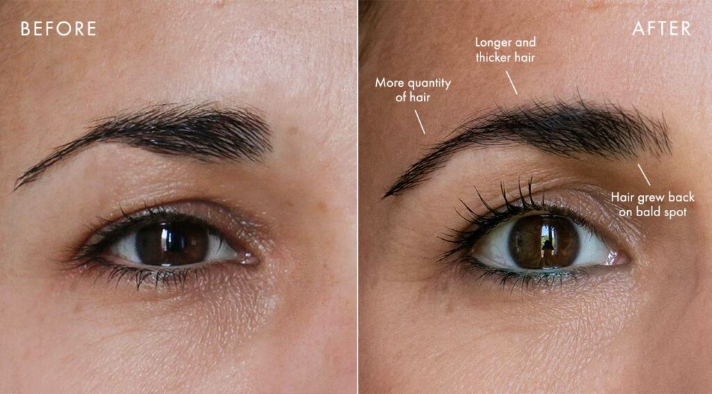 Alpha Hair as an Eyebrow Growth Serum | LE PURE
